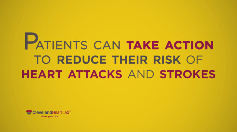 Know Your Risk Video - Cleveland HeartLab, Inc.