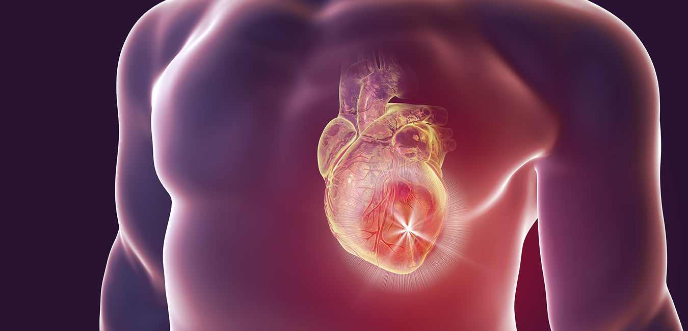 Preventing Heart Failure - Cleveland HeartLab, Inc.